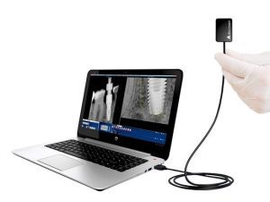 Raio - X Portátil e Sensor Digital na Odontologia